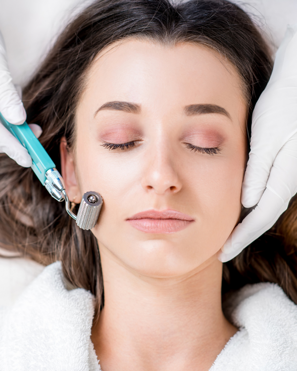 Micro Needling - Facial Excellence